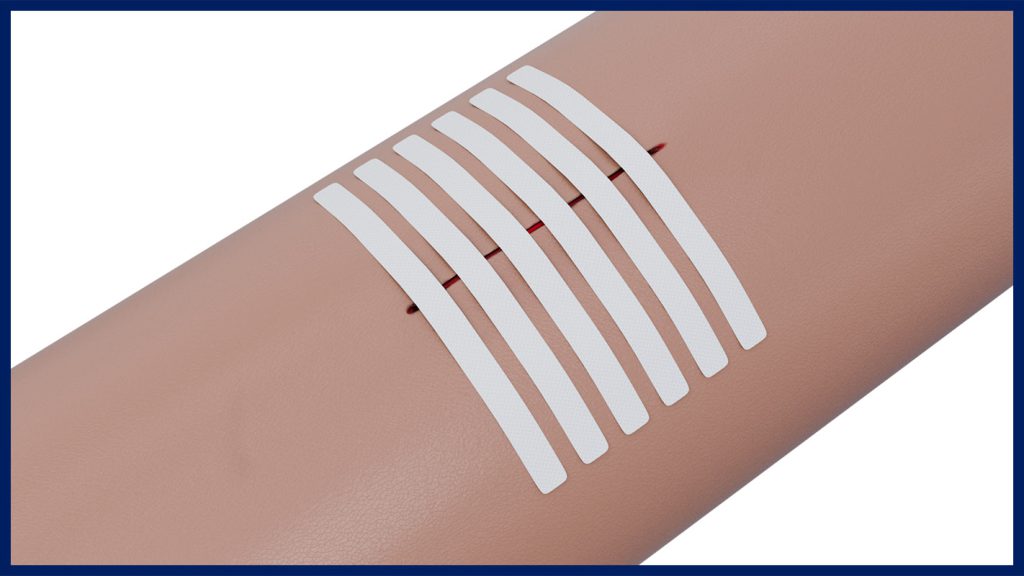 Curativo Tiras Para Sutura Estéril Strip Fix – Polar Fix