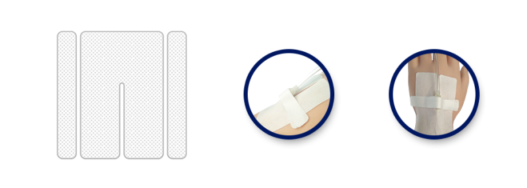 Fixador IV Estéril Polar Fix – Polar Fix